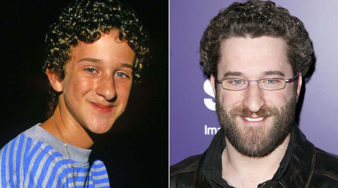 Addio a Dustin Diamond: interpretò Screech in Bayside School - Tgcom24
