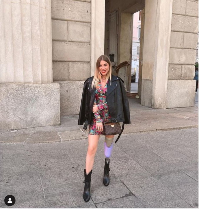 Nina Rima è in dolce attesa: la modella senza gamba avrà una bimba