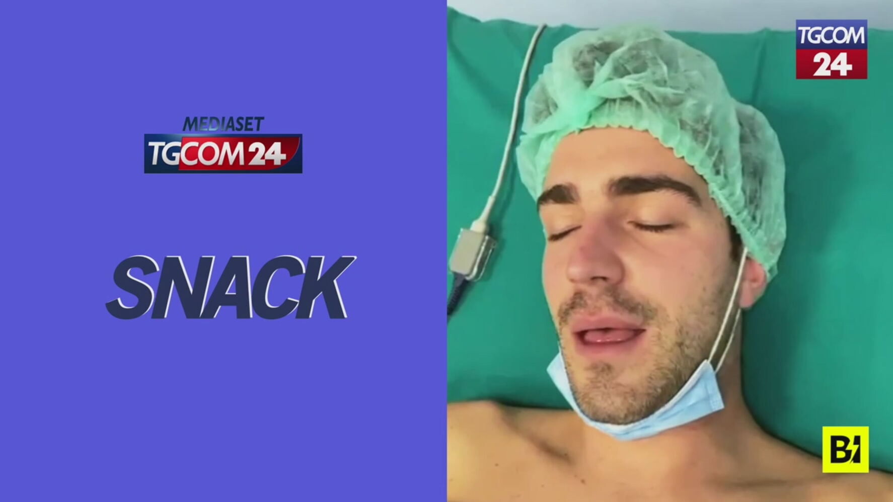 Delicata operazione chirurgica per Tommaso Zorzi: l'influencer è stato circonciso