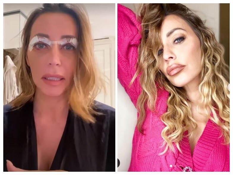 Karina Cascella fa blefaroplastica: via palpebre da pesce lesso